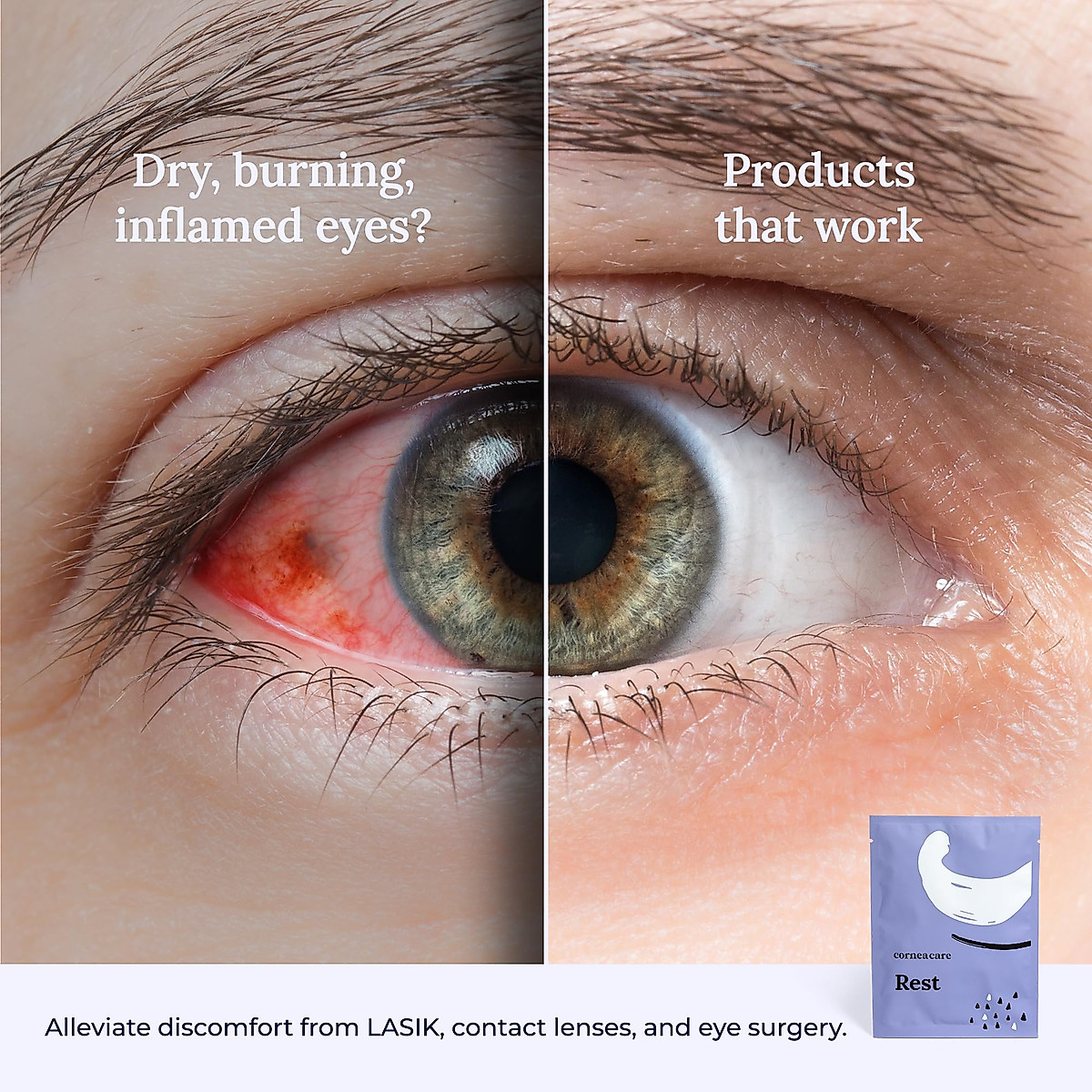 CorneaCare Rest: Self Heating Warm Compress for Eyes | Heated Eye Mask for Fast Relief of Dry Eyes | No Microwave Needed | Eye Treatment Products for Dry Eye Relief | 30 Count | FSA & HSA Eligible