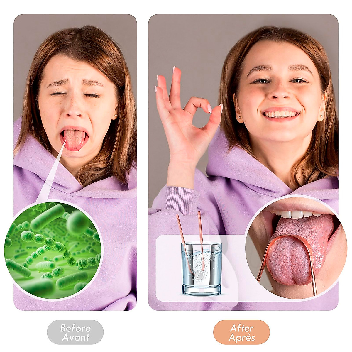 JUIDINTO Tongue Scraper 2 Pack, 100% Stainless Steel Tongue Scraper for Adults, Easy to Use Tongue Scraper with Case, Cleaning Tongue and Reducing Bad Breath for Oral Care