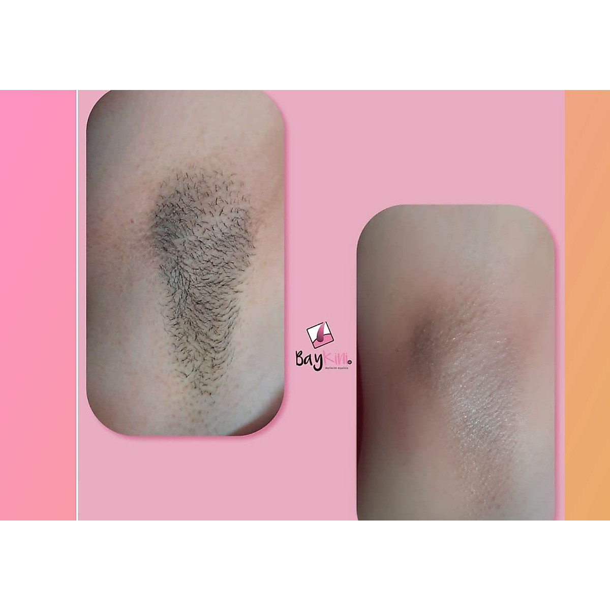 Hard Wax ready to use in microwave, no irritation, no strips needed. Berries sensitive skin.