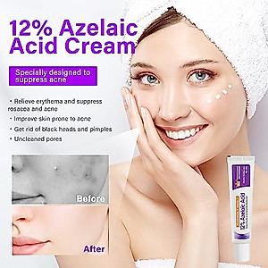 Azelaic Acid 12% Facial Serum,Skin Brightening Hyaluronic Acid and Niacinamide, Redness Relief, Fade and Repair Dark Spots