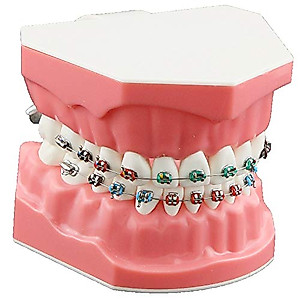 Dentalmall Typodonts Orthodontics Demonstration Model with Metal Wires and Bracket Teaching, Learning, Interpretation Model for Adults and Children (Metal Bracket)