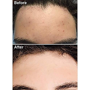 Teenology Conditioner for Teens - Avoid Forehead and Body Acne - Sulfate and Paraben Free, Noncomedogenic, Natural Botanical Extracts, Vanilla Almond - 16 oz.