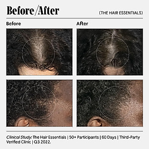 Nécessaire The Conditioner. Hyaluronic Acid + Vitamin B Complex. Fragrance-Free. Approved by the National Eczema Association.