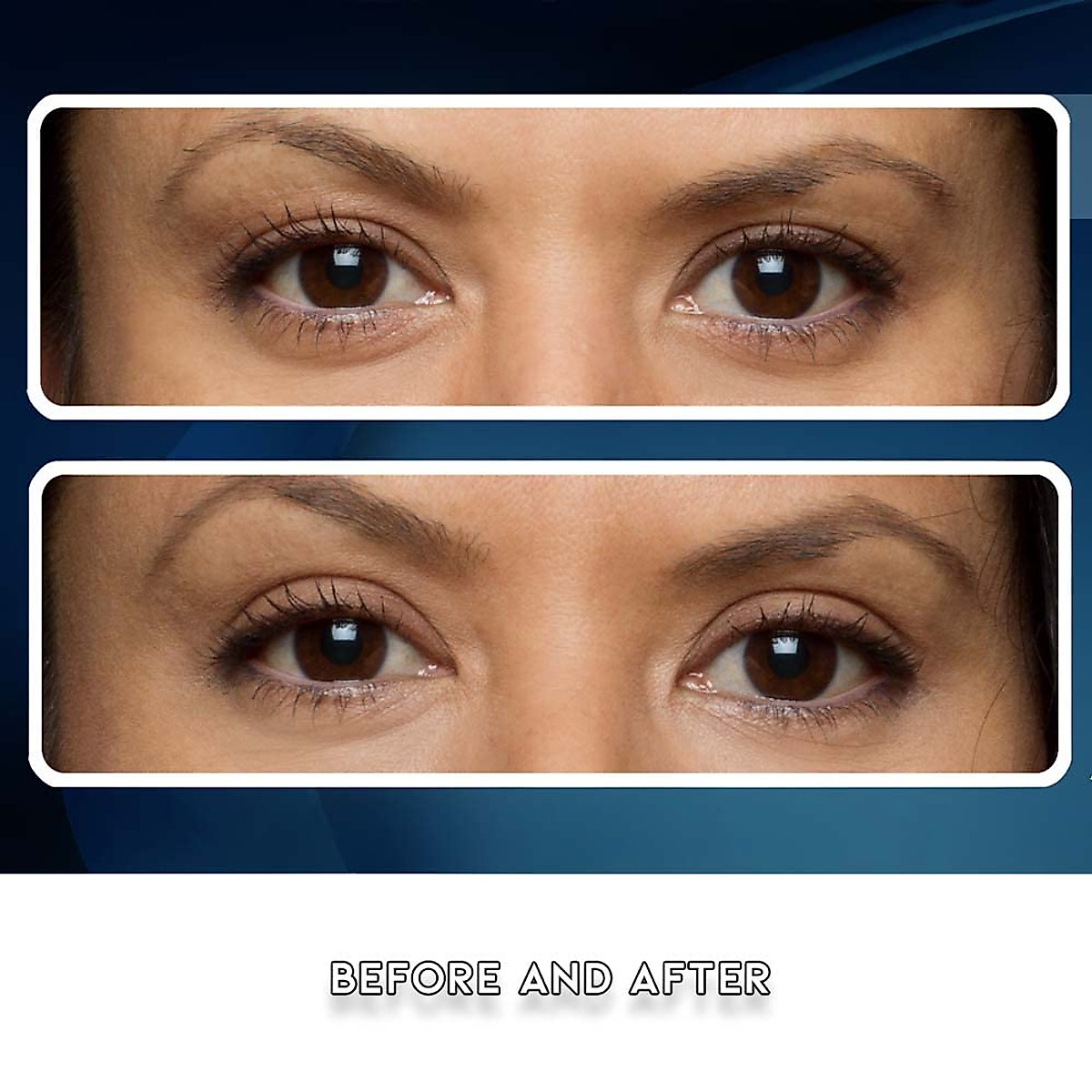 Eye Magic Premium Eye Lift (S/M Refill) Made in America. Instantly Lifts and Defines Droopy, Sagging or Hooded Eyes Safe for Daily Use