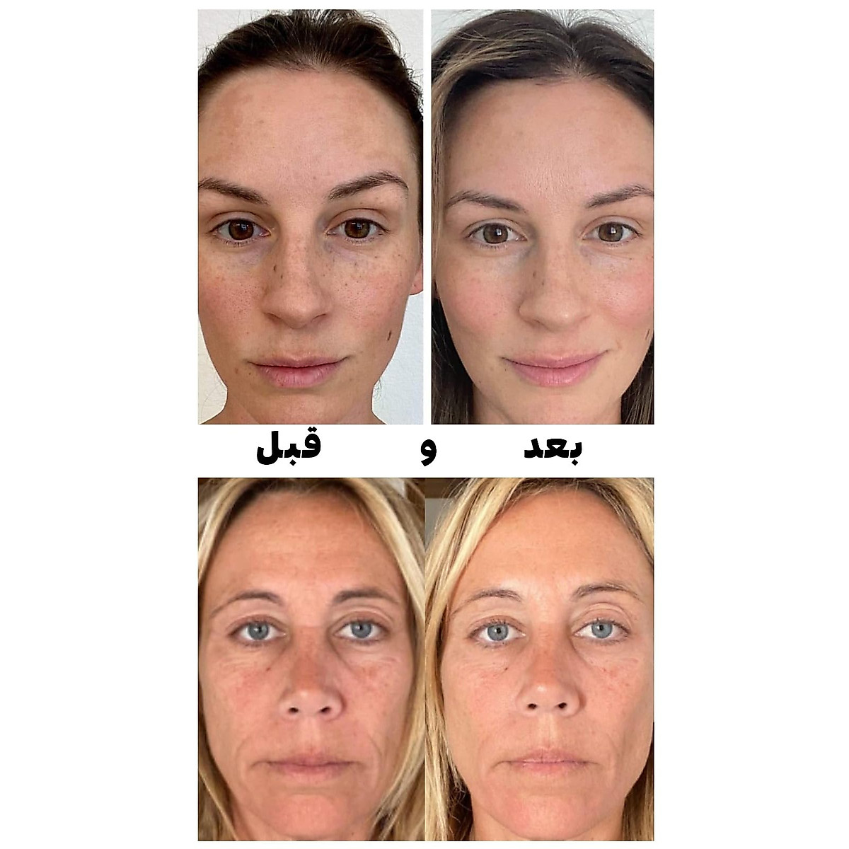 Neumi Skin 3.4 FL OZ Facial Spray (Nano-Formulated) with Glutathione, Collagen, and Hyaluronic Acid, Face Care & Firm, Pore Minimizer Face Spray, Reduce Fine Lines and Wrinkles, (1 Pack)