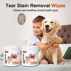 Dog Eye Wipes, Tear Stain Remover for Dogs and Cats, Finger Eye Wash Pads for Pets, 100 Count Dog Eye Cleaning Wipes, Unscented & Gentle Pet Tear Wipe, Removes Dirt and Discharge