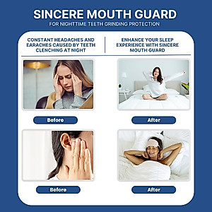 Sincere Moldable Mouth Guard for Teeth grinding & clenching at Night, Dental Night Guard, Bite Guard for Teeth Clenching Nighttime, Teeth protection for Sleep, 2 Sizes, Pack of 8 with 2 Travel Cases