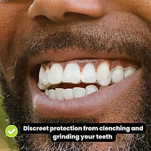 SENTINEL MOUTHGUARDS No-Show Daytime Mouth Guard for Teeth Grinding and Clenching | Custom Fit for Durability and Protection | BPA-Free and Dentist-Approved | Made in USA