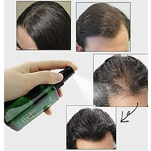 Anti-Hair Loss Spray Hair Nutrient Solution, 120 ml