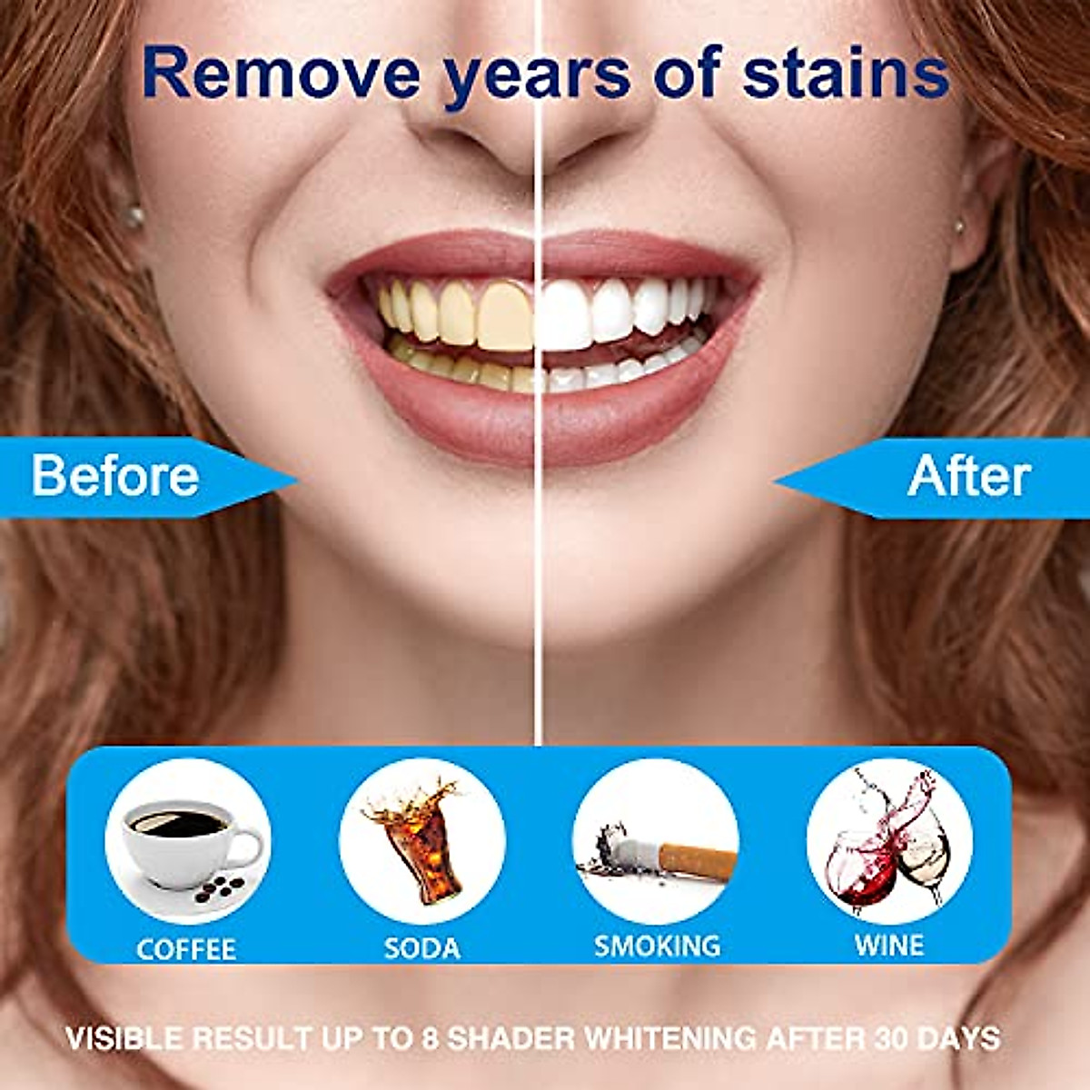 EZGO Teeth Whitening Strips, 28 Non-Sensitive White Strips Teeth Whitening Kit, 14 Sets Fast-Result Teeth Whitener for Tooth Whitening, Helps to Remove Smoking, Coffee, Wine Stains, Gentle and Safe