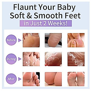 Vemofoper Hand and Foot Peel Mask Set with Lavender for Dry Cracked Skin, Hydrating & Moisturing Socks(4pack)+Gloves(2pack)