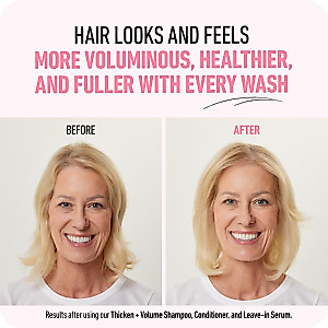 Boldify Thicken Volume Conditioner - Ultimate Biotin Formula for Hair Thickening, Split End Repair, Nourishment, and Fine or Oily Hair for Women & Men