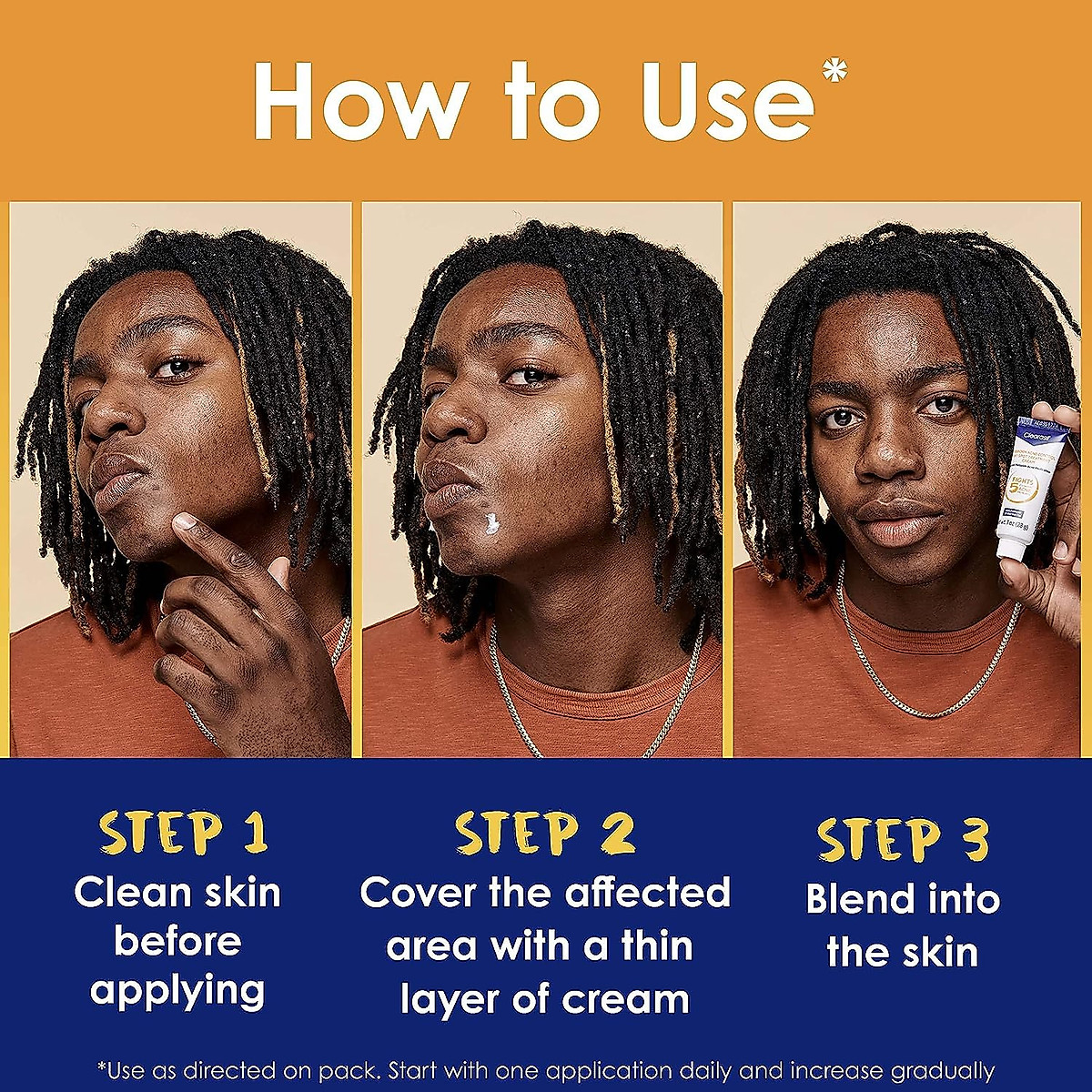 Clearasil Stubborn Acne Control 5in1 Spot Treatment Cream, Maximum Strength, Benzoyl Peroxide Acne Medication, Fights Blocked Pores, Pimple Size, Excess Oil, Acne Marks & Blackheads, 1 oz (Pack of 4)