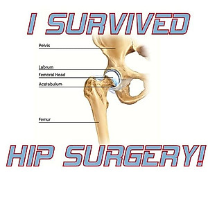 CafePress Hip Surgery Mug Ceramic Coffee Mug, Tea Cup 11 oz