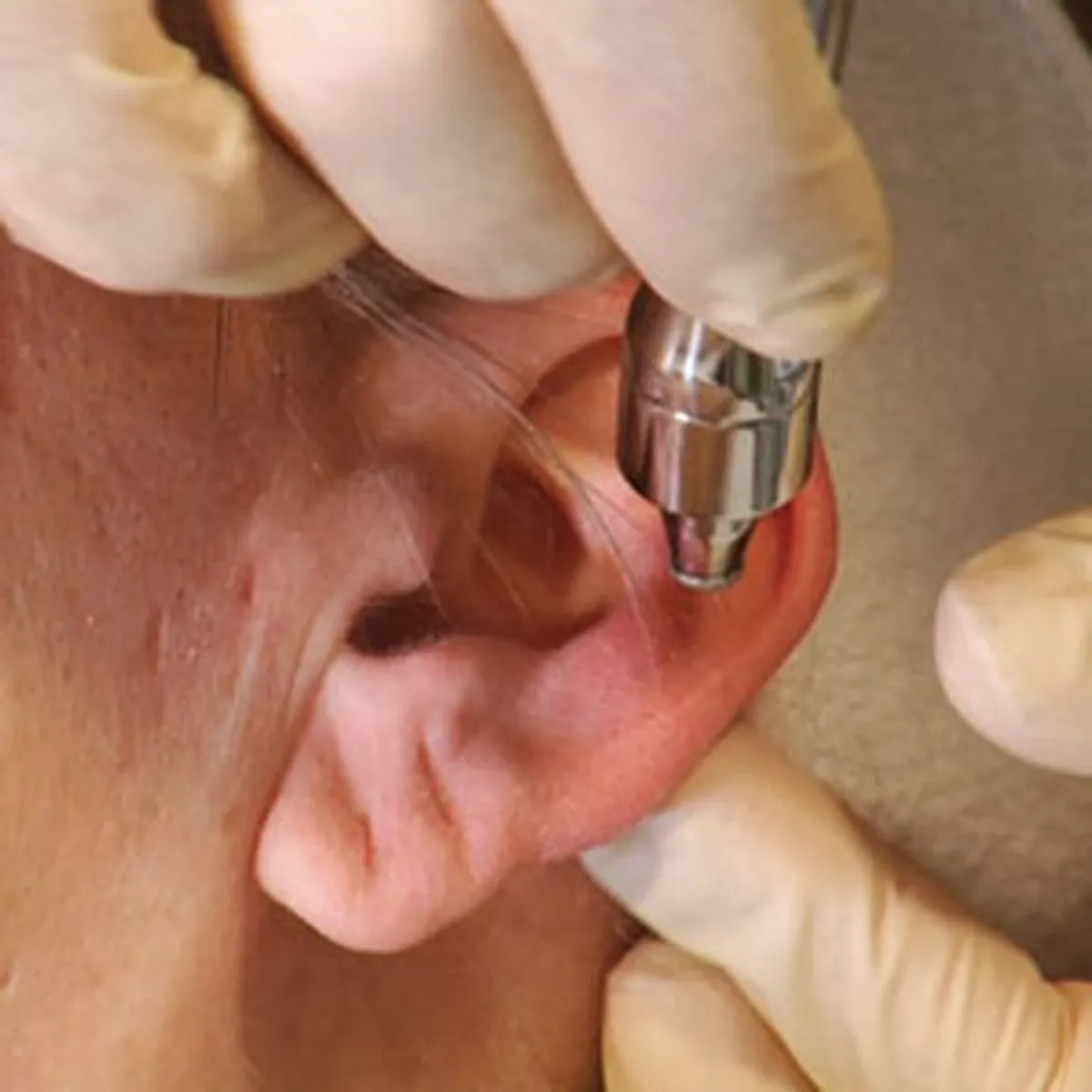 Microdermabrasion: Crystal-Free Techniques DVD - Learn How To Use a Microderm Machine In This Skin Care Training- Learn Cosmetic Procedures For a Complete Skin Rejuvenation Facial Treatment - Won A Telly Award - Best Video (2 Hrs. 7 Mins.)