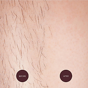 Nad's Brazilan & Bikini Wax Kit, Hair Removal For Women, Body Wax Specifically For Coarse Hair, At Home Waxing Kit With Hard Wax + Calming Oil Wipes + Wooden Spatula