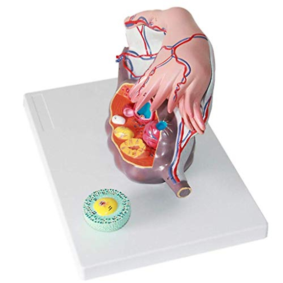 DEAVER Uterine Anatomy Model Ovarian Enlargement Model Skin and Genitourinary System Anatomical Medical Educational Training Aid,Medical Models & Educational Materials