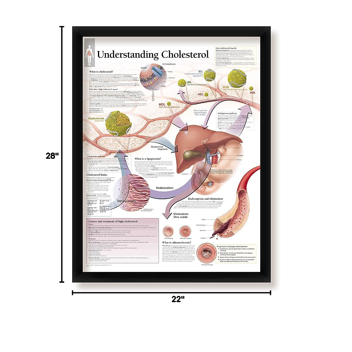Set of 4 Framed Medical Posters Understanding Diabetes Understanding Cholesterol Understanding Metabolic Syndrome and Understanding Hepatitis 22"x28" Wall Diagrams