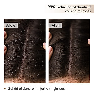 mCaffeine Naked and Raw Coffee Scalp Scrub - Scalp Cleanser Dandruff Removal - Suitable for All Hair Types - Natural Aha - Scalp Exfoliation - 8.82 oz