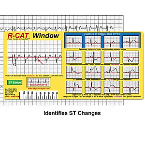 R-CAT EKG Window 2nd Edition