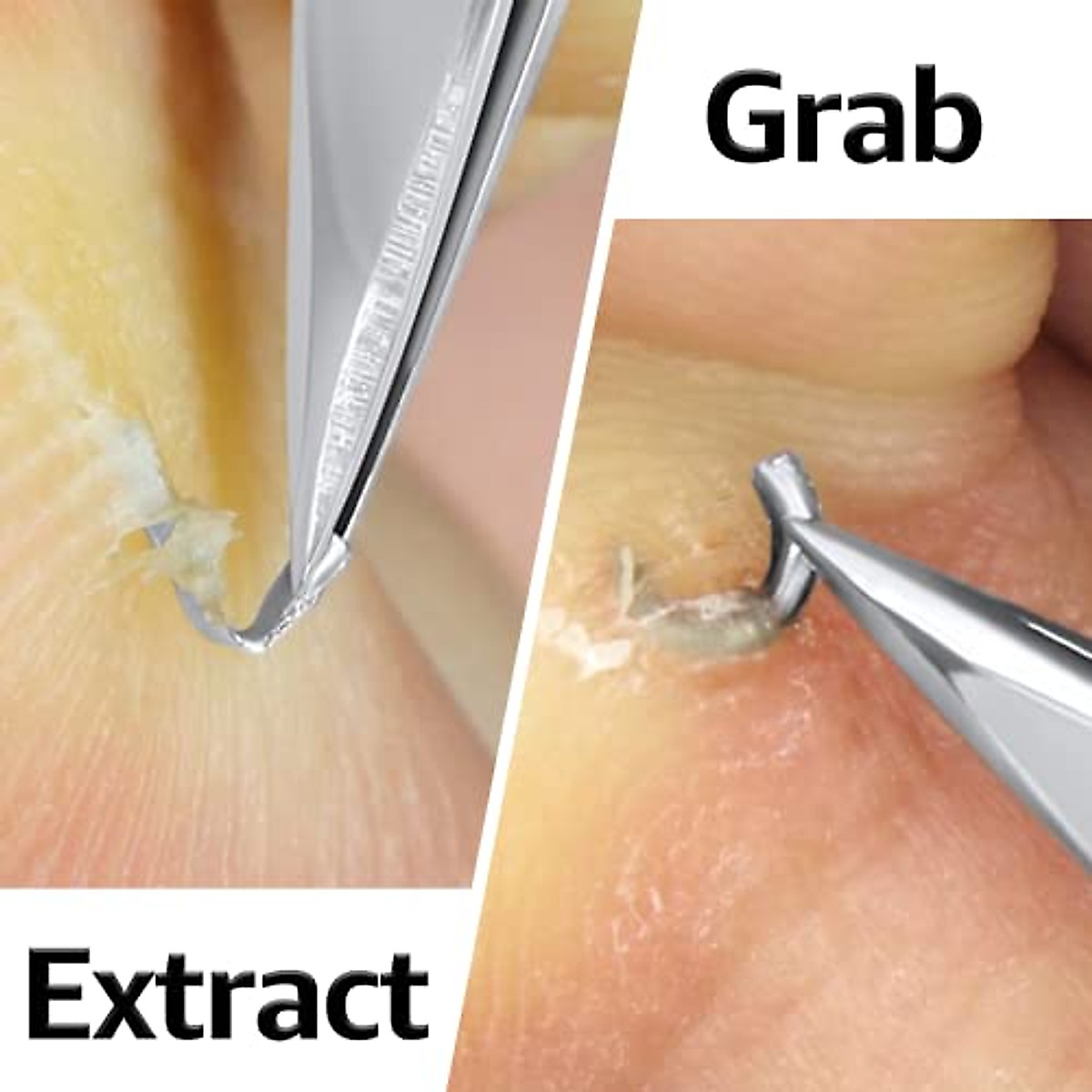 DUROX - Splinter Remover. Great For First Aid Kit Camping. Medical Tweezers To Tweeze Splinter Out. Splinter Remover Kit. Splinter Tweezers. Surgical Tweezers. First Aid Kit Tweezers…