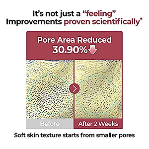 numbuzin No.3 Skin Softening Serum | Pore Care, Textured Skin, Bifida, Galactomyces, Niacinamide, Adenosine, Panthenol | Korean Skin Care for Face (1.69 Fl Oz)