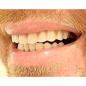 Instant Smile Comfort Fit Flex Teeth - Natural Shade Upper and Lower Kit with Vented Cleaning Case