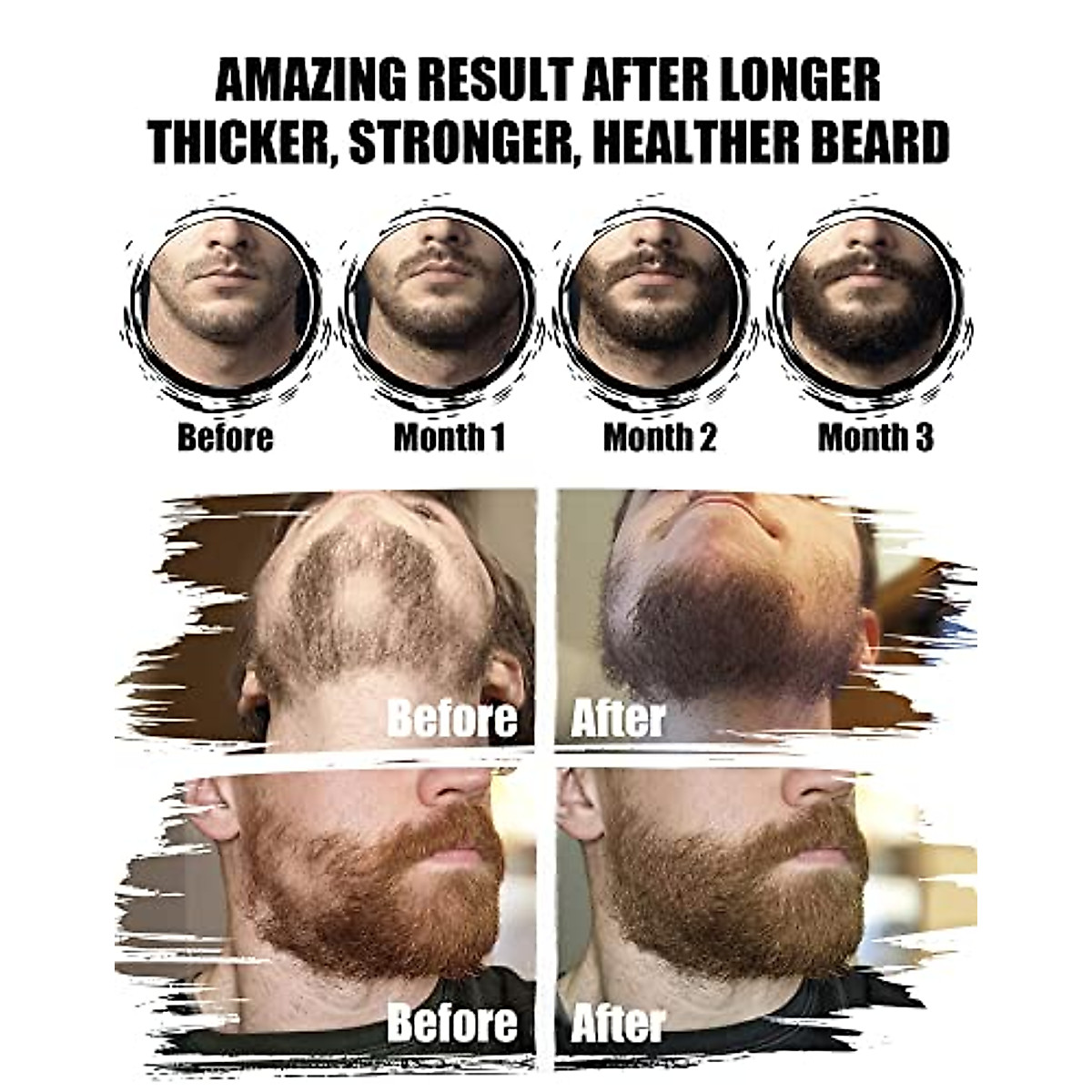 Beard Growth Kit, Beard Kit with Beard Roller, 2 Pack Beard Growth Oil,Beard Brush,Wash Conditioner for After Shave Lotions,Balm,Combs,Razor & Brush Stands Scissor, Christmas Fathers Gifts for Men