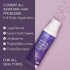 Seroflora Razor Bumps Serum-Ingrown Hair Treatment for Women-Razor Bump for Bikini Area - After Shave & Waxing - Roll-On-Face, Legs, Body (3.5floz)