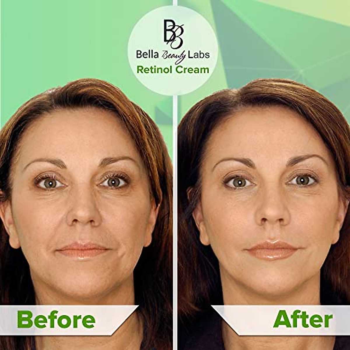 Retinol Moisturizer Anti Aging Cream for Face and Eye Area - With Hyaluronic Acid - 2.5% Active Retinol - Vitamin E - Reduce Appearance of Wrinkles and Fine lines - Best Day and Night Face Cream