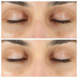 Murad Vita-C Eyes Dark Circle Corrector – Environmental Shield Vitamin C Brightening Serum – Anti-Aging Treatment for Puffiness and Wrinkles, 0.5 Fl Oz