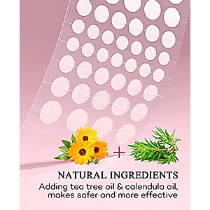 TKTK Pimple Patches Acne Patches For Face 4 Sizes 176 Patches Hydrocolloid Patch Acne Absorbing Zit Patch Easy To Peel, Add Tea Tree & Calendula Oil