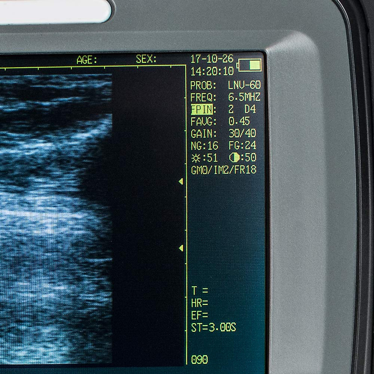 Veterinary Ultrasound Scanner HandScan V8 for Pregnancy Digital Veterinary Ultrasonic Scanner Machine with Convex Probe for Farm Animals Pet - US New Version