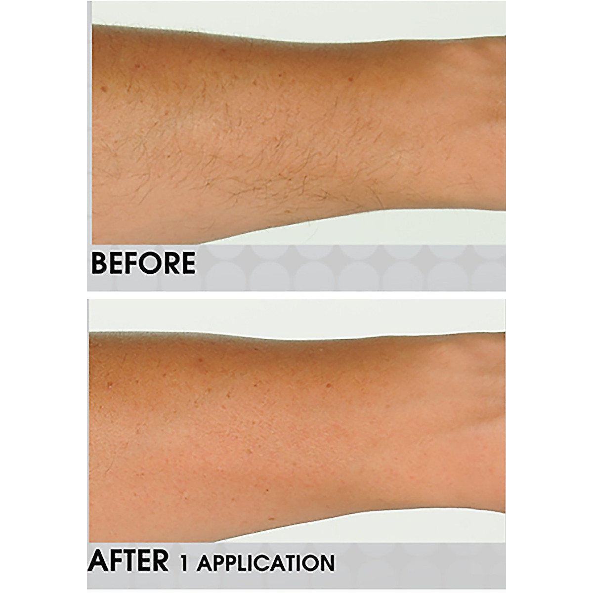 Epilady Drop Rechargeable Wet/Dry Epilator - Hair Removal Epilator, Cordless Wet/Dry Hair Remover for Women, Epilator for Shower