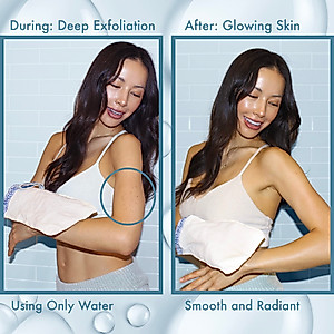 MicrodermaMitt Deep Exfoliating Mitt for Shower – Dead & Dry Skin Remover - Keratosis Pilaris – Body Exfoliator Glove for Men & Women - No Dyes
