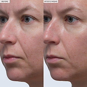 Glow Recipe Plum Plump Hyaluronic Acid Skin Care Serum - Hydrating Skincare + Face Serum for Women & Men with Antioxidant Plum + Vitamin B5 to Repair Skin Barrier & Lock-In Facial Hydration (30ml)