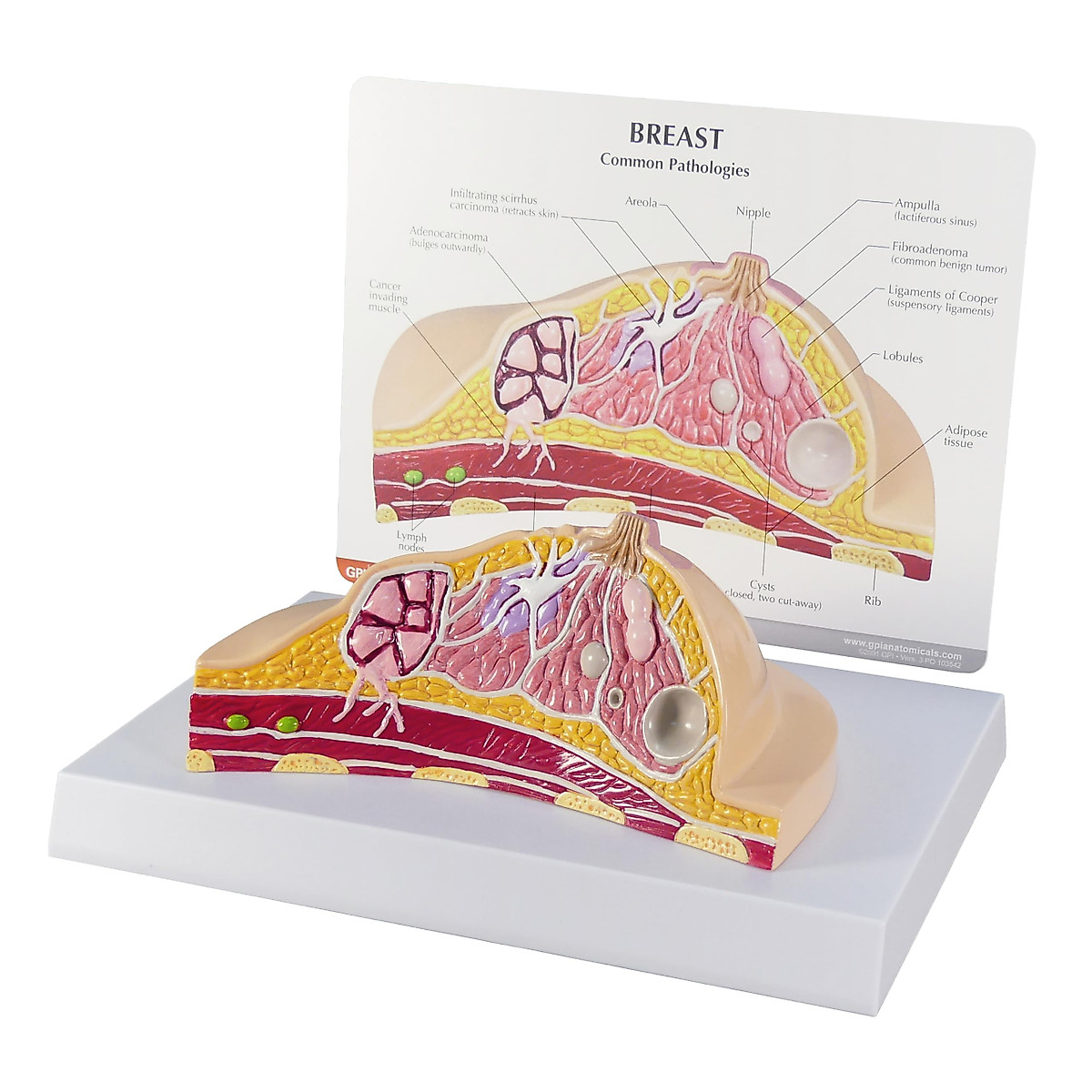 Breast Cross-Section Model | Human Body Anatomy Replica of Breast w/Common Pathologies for Doctors Office Educational Tool | GPI Anatomicals