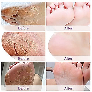 WEIDA SIGN Foot Peel Mask 3 Pack,For Cracked Heels, Dead Skin & Calluses - Exfoliator Remove Repair Rough Heels,Make Your Feet Baby Soft & Get a Smooth Skin (Lavender)
