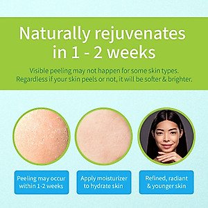 Ebanel 30% AHA 2% BHA Chemical Peel Exfoliant Gel, Face Peel with Glycolic Acid, Salicylic Acid, Lactic Acid, Green Tea, Chamomile for Acne Scars, Dark Spots, Wrinkles, Fine Lines