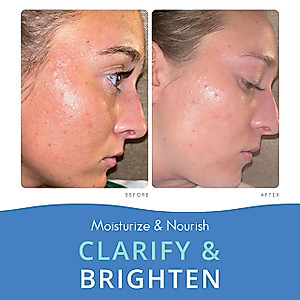 Almond Clear 2-in-1 Hydrating Gel | Lightweight Mandelic Acid Moisturizer for Oily, Blemish-Prone Skin | Aloe Vera, Squalane, Hyaluronic Acid, Mandelic Acid, Bakuchiol | 4 oz