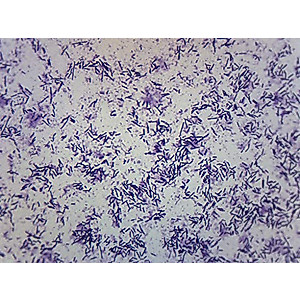 EISCO (Pack of 25) Escherichia Coli Smear, Gram Stain, Prepared Microscope Slides - 75 x 25mm - Classroom Pack, 25 Slides in Storage Case - Biology & Microscopy