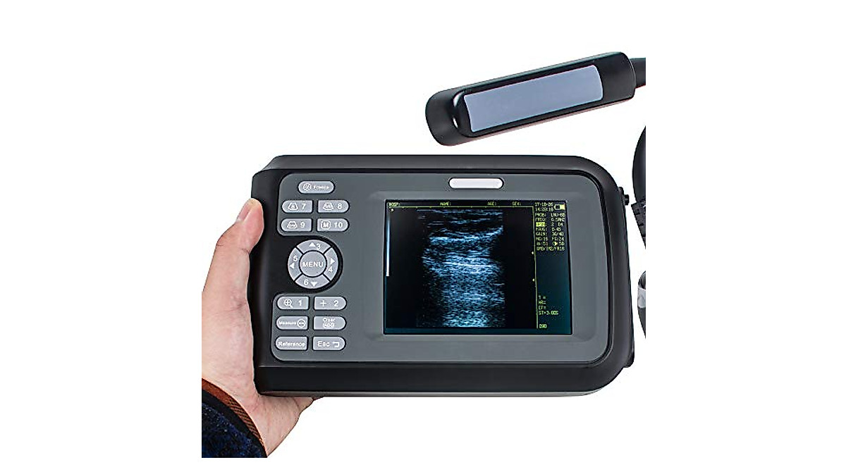 Portable Veterinary Ultrasound Scanner for Large Animals