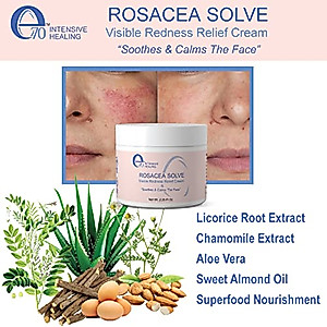 E70 Rosacea Solve - Redness Relief Cream - Calming Face Moisturizer For Rosacea and Acne-Prone Skin - Sensitive Skin Care With Organic Ingredients such as Aloe Vera, Almond Oil, Licorice and Chamomile Extracts - No Parabens