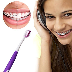 Angzhili Portable Orthodontic Toothbrush Kit for Orthodontic Patient Orthodontic Care Kit for Braces,Interdental Brush,Dental Wax,Dental Floss,Dental Travel Kit(Purple)