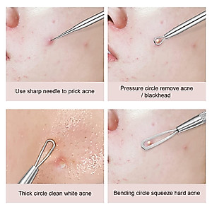 Blackhead Remover, 2 PCS Pimple Popper ，Stainless Steel Pimple Extractor Blackhead Removal Tool Risk Free Treatment for Blemish,Whitehead Popping