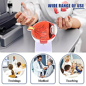 HINGONS 6X Enlarged Human Eye Anatomical Model, Anatomically Eyeball Display Model with Removable Stand for Medical Science Education & Anatomy