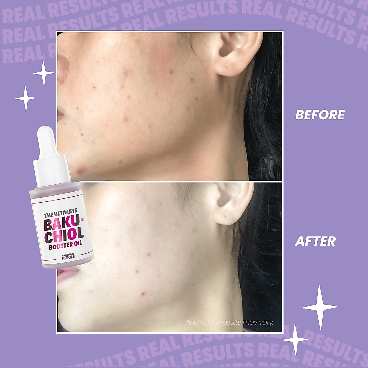 Handmade Heroes 2% Bakuchiol Booster Oil with Sugarcane Squalane, All Natural Retinol Alternative For Radiant and Line Smoothing 0.75oz