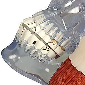 GPI Anatomicals - Temporomandibular Joint (TMJ) Model, Replica with Pathologies for Human Anatomy and Physiology Education, Anatomy Model for Doctor's Offices and Classrooms, Medical Study Supplies