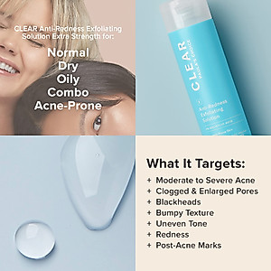 Paula's Choice CLEAR Extra Strength Exfoliator, 2% Salicylic Acid Exfoliant for Acne, Redness Relief, 4 Ounce