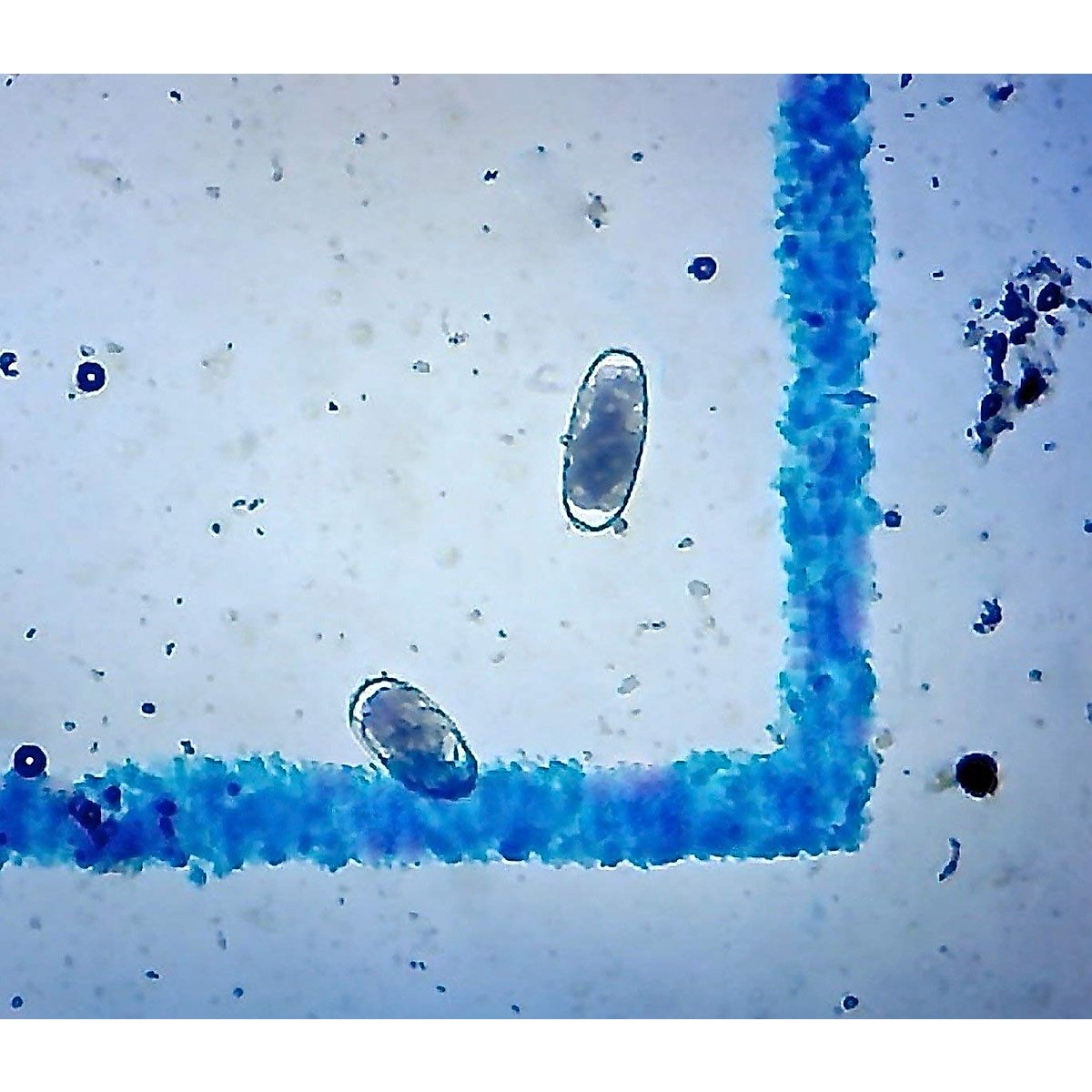Bundle of 2 McMaster Method Microscope Slides, FEC (Fecal Egg Count) Double Chamber Slide for Parasite Testing, Count Parasite Eggs in Horses, Sheep, Goats, Cattle.